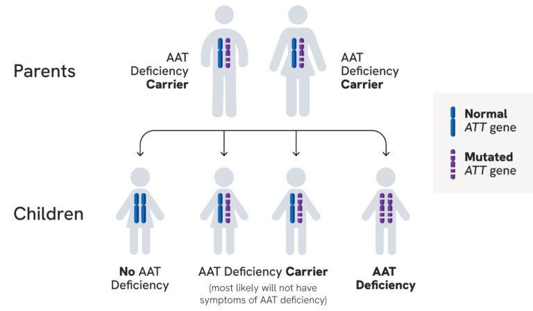 Causes of Alpha-1 Antitrypsin Deficiency | Alpha-1 Foundation